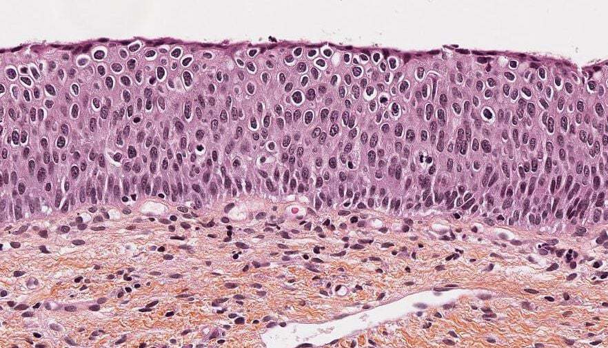Meet the winners of TissueNet: Detect Lesions in Cervical Biopsies ...